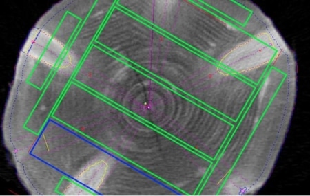 CT Log Scanner - Nukor Sawmilling, Woodworking & Agricultural Equipment ...
